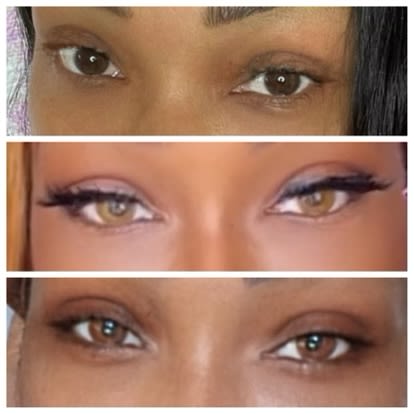 Tiny Eye Color Surgery
