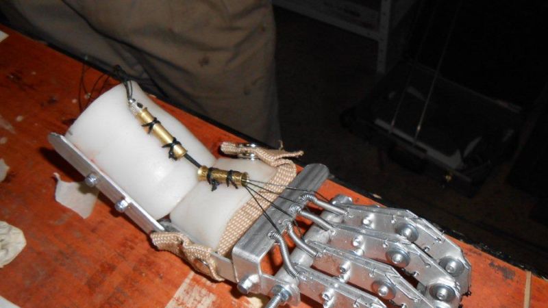 Carpenter Who Cut Off His Fingers Builds A ‘robohand Cnn Business
