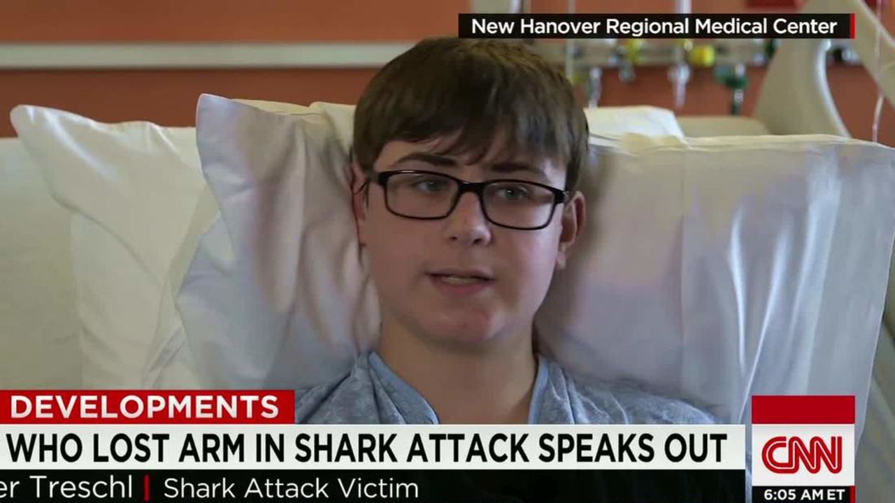 Shark Attack Victim ‘i Didnt See It Coming Cnn
