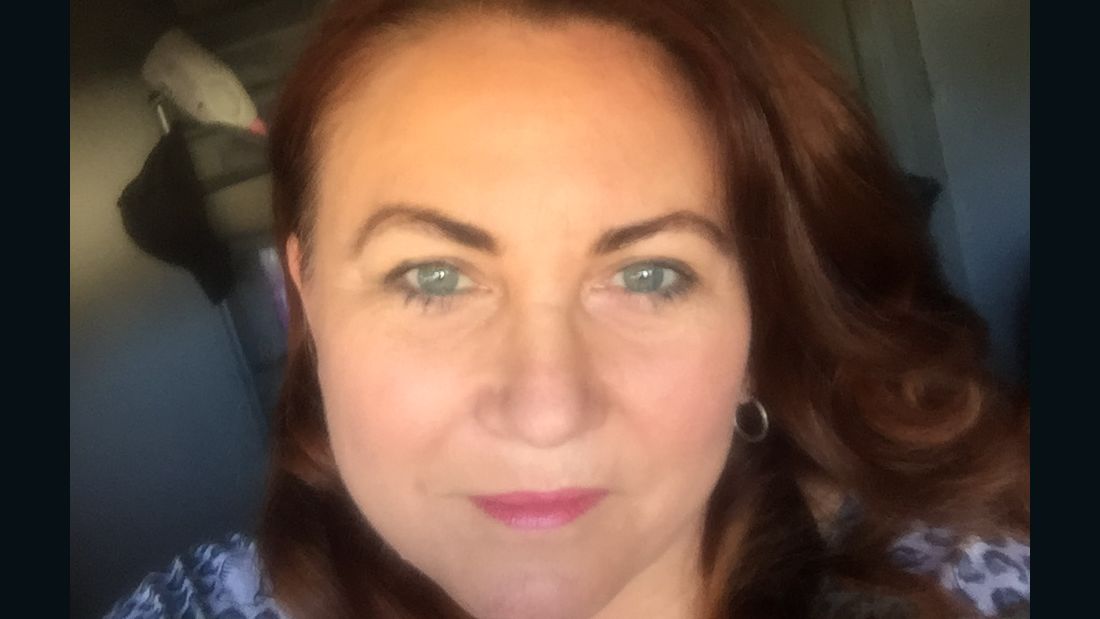Australia Investigates Implants That Left Some Women With ‘rotting Pelvises Cnn