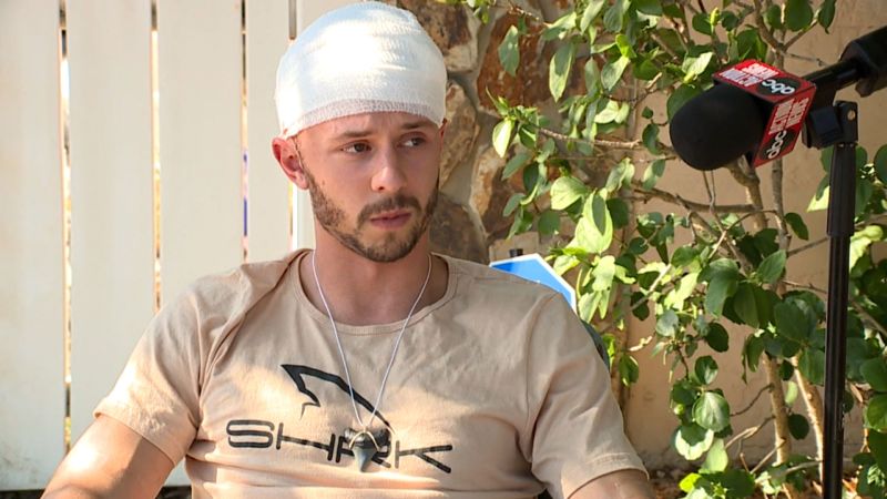 Man looking for shark teeth in a Florida river survives an alligator ...