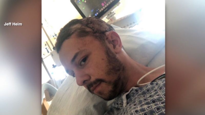 ‘An inch away from death’: Man describes alligator attack | CNN