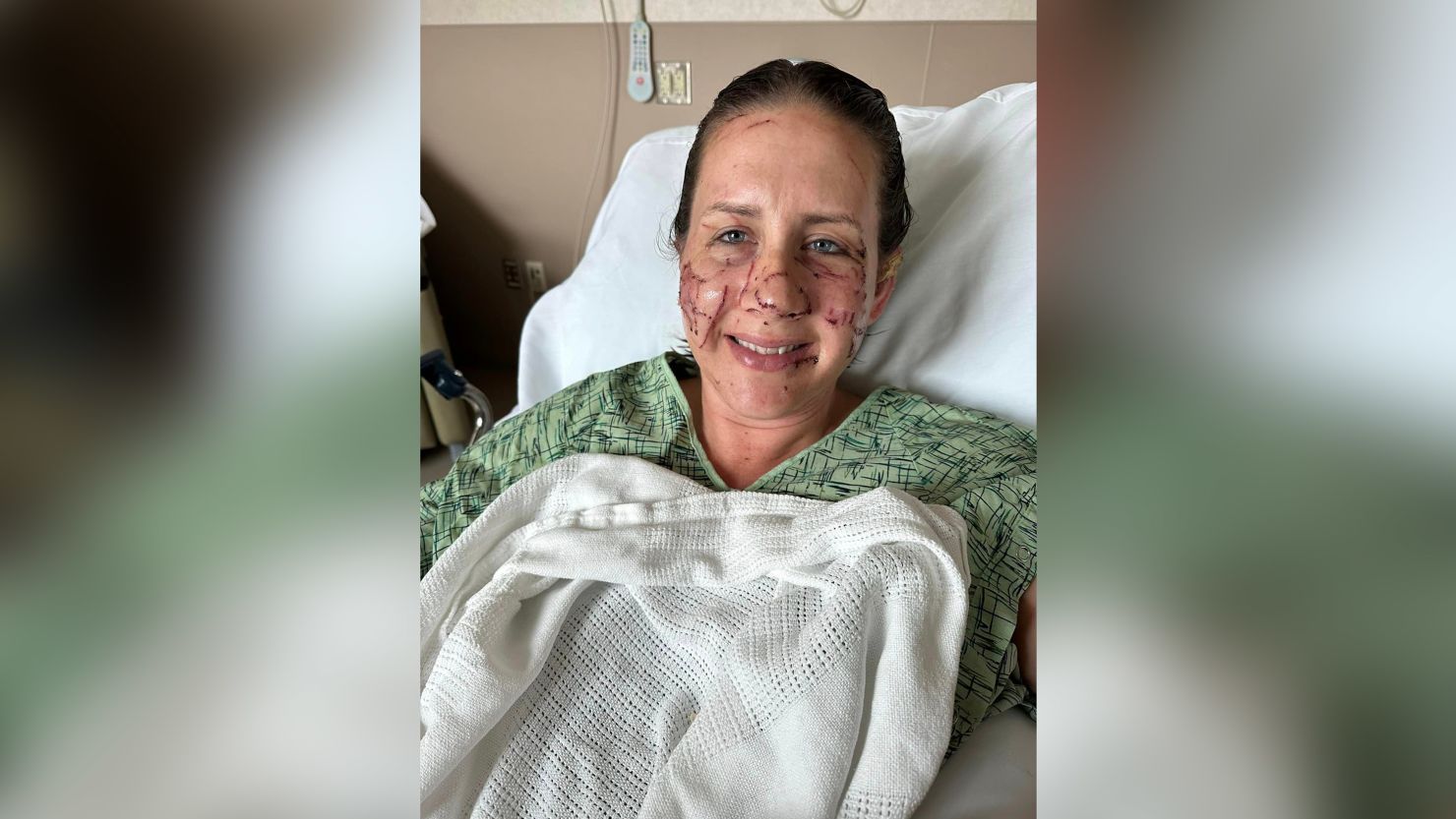 Woman attacked by ‘vicious’ otter in Montana | CNN