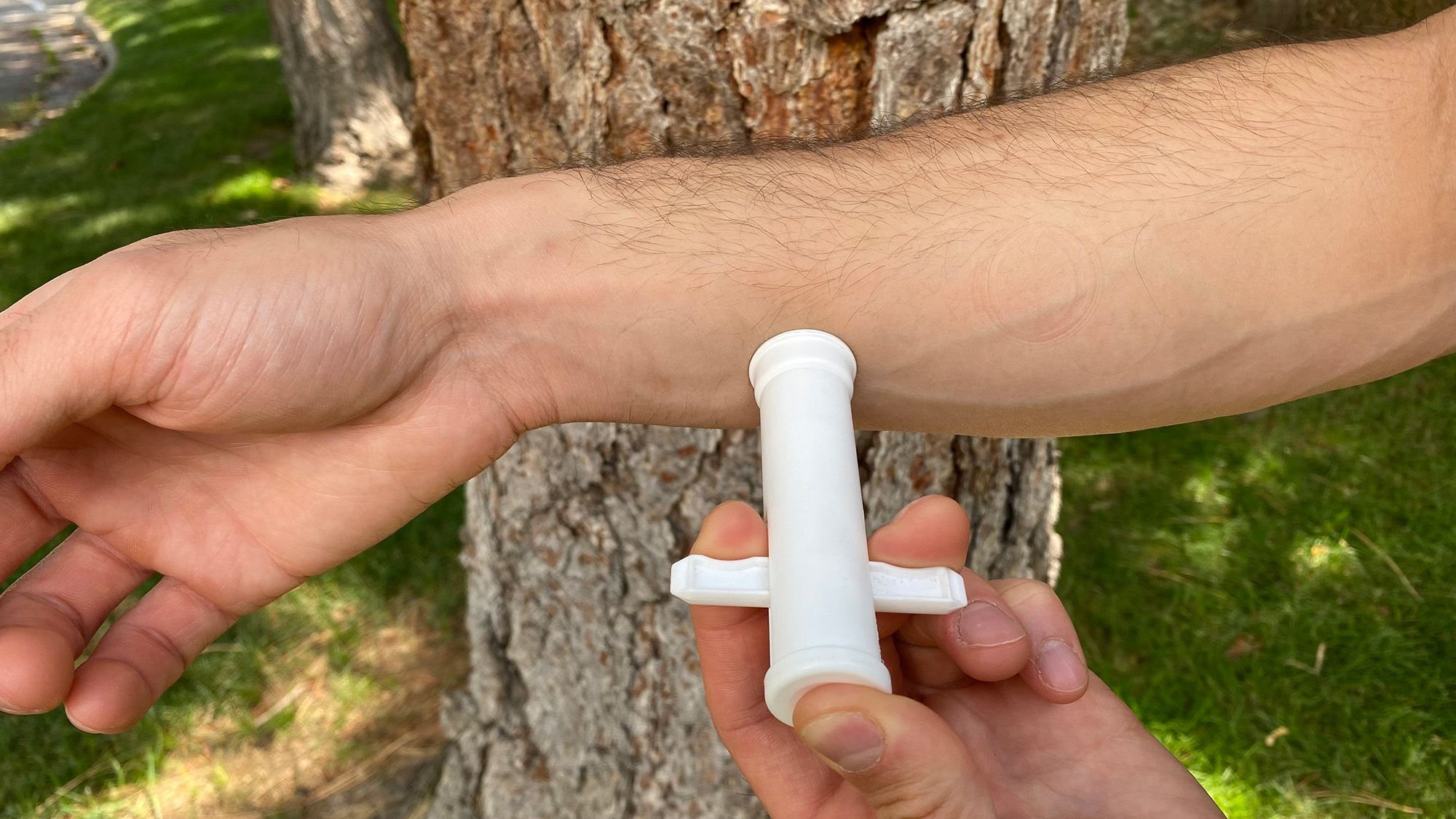 Bed Bug Bite On Finger