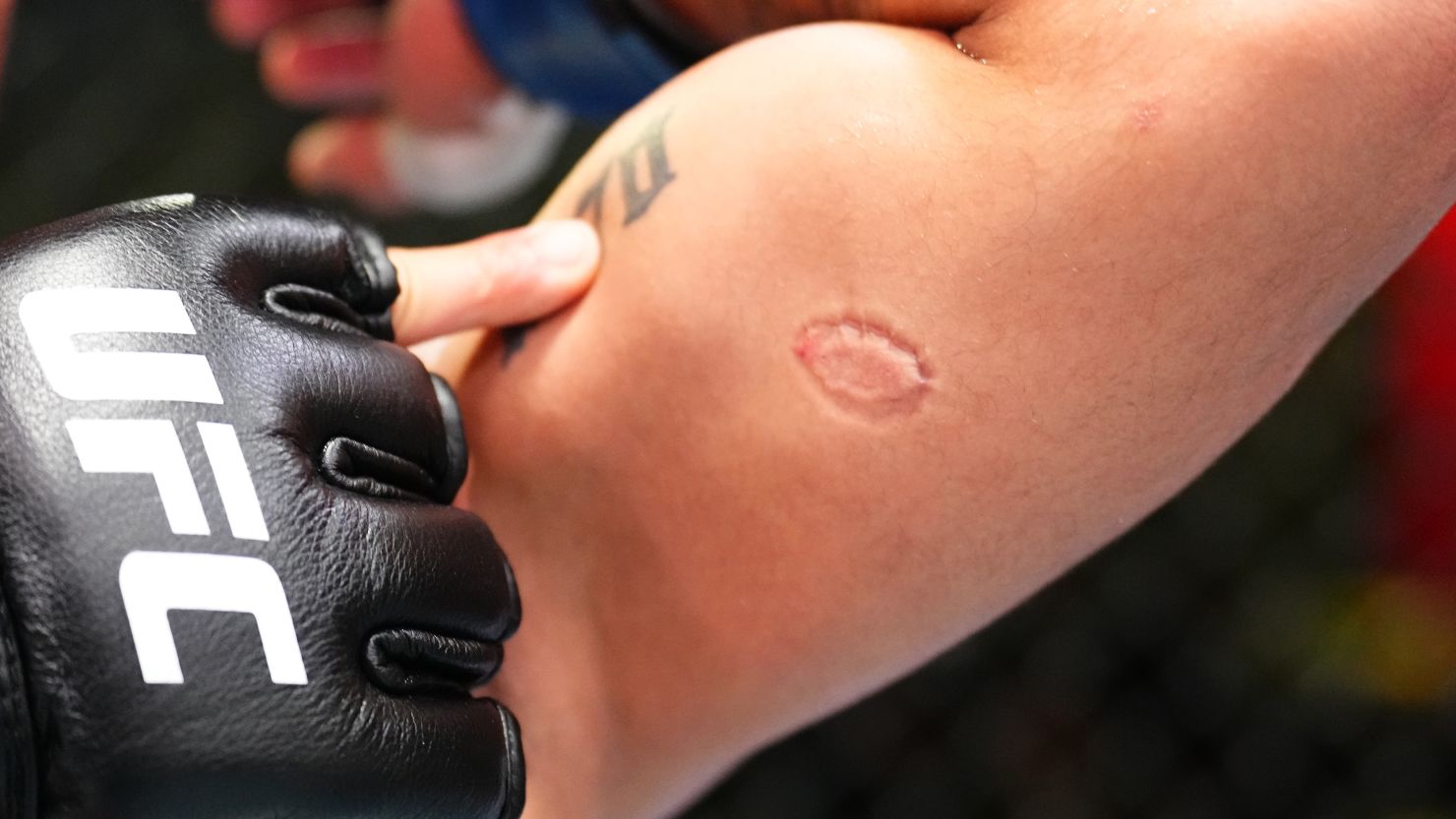 Andre Lima Vs Igor Severino Ufc Fighter Disqualified For Biting Opponent Cnn